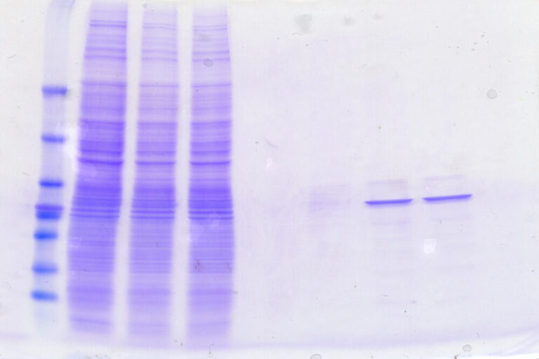 【SDS-PAGE】タンパク質を分子量で分ける原理から失敗例まで解説！ - 生命科学ラボ